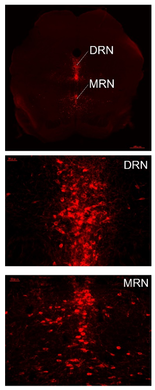Anti TPH2 (tryptophan hydroxylase 2) pAb (Guinea Pig, Affinity Purified ...