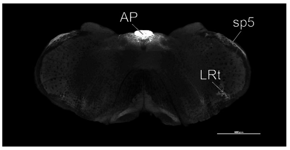 CaSR pAb (GP)-多抗-深圳欣博盛生物科技有限公司