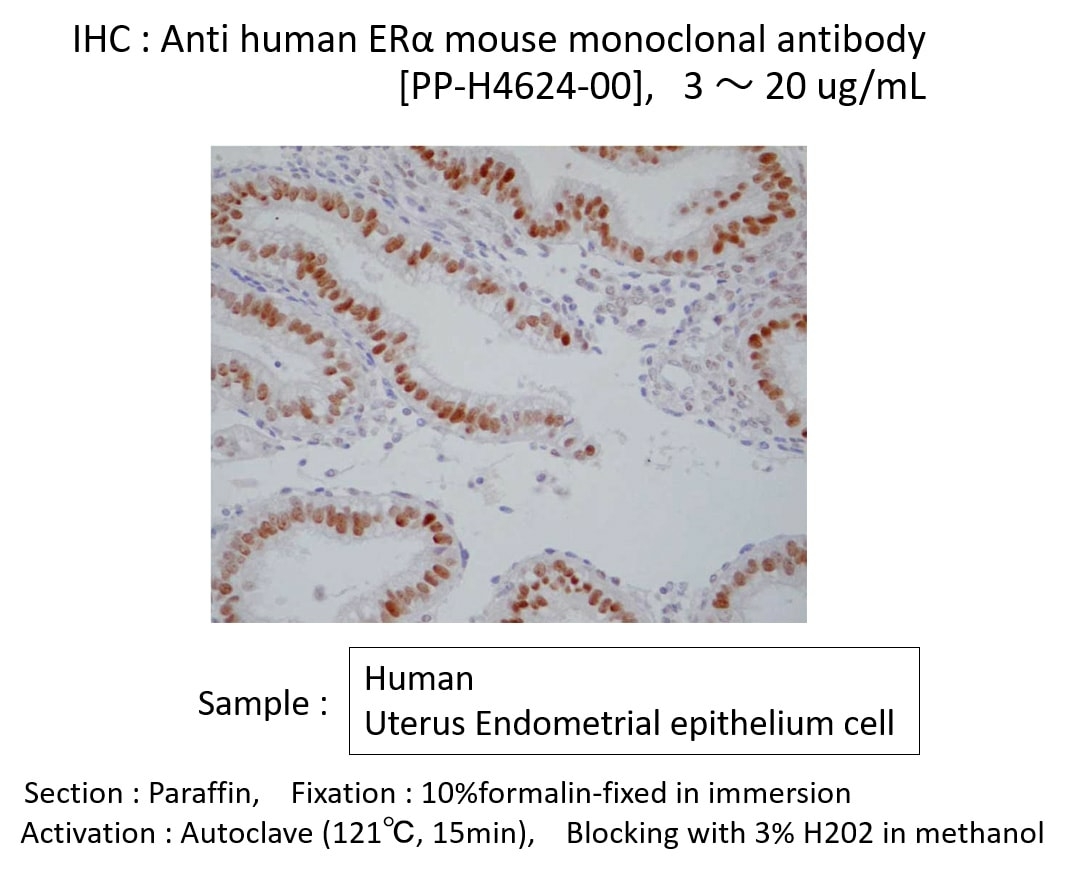 Anti Estrogen Receptor 1 (ESR1/ER-Alpha) mAb (Clone H4624)-单抗-深圳欣博盛生物科技有限公司